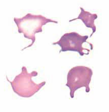 Celulas Sanguineas: Atlas de hematología: Anormalidades serie eritroide.