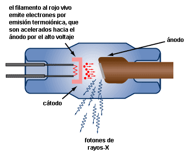 Unidad1 : ¿Cómo se producen los rayos X?