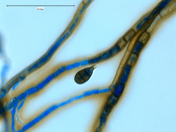 Fun With Microbiology (What's Buggin' You?): Pithomyces species
