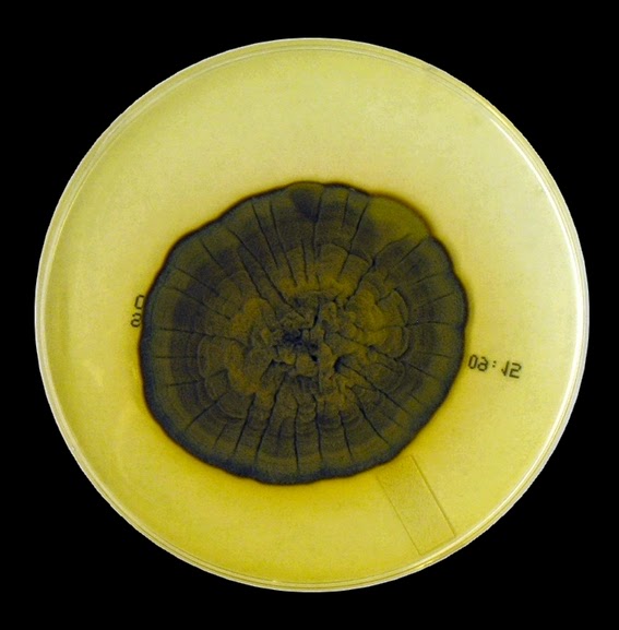 Fun With Microbiology (What's Buggin' You?): Ochroconis species