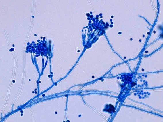 Fun With Microbiology (What's Buggin' You?): Paecilomyces variotii