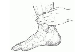 ACUPRESSURE POINT FOR PAINLESS NORMAL DELIVERY