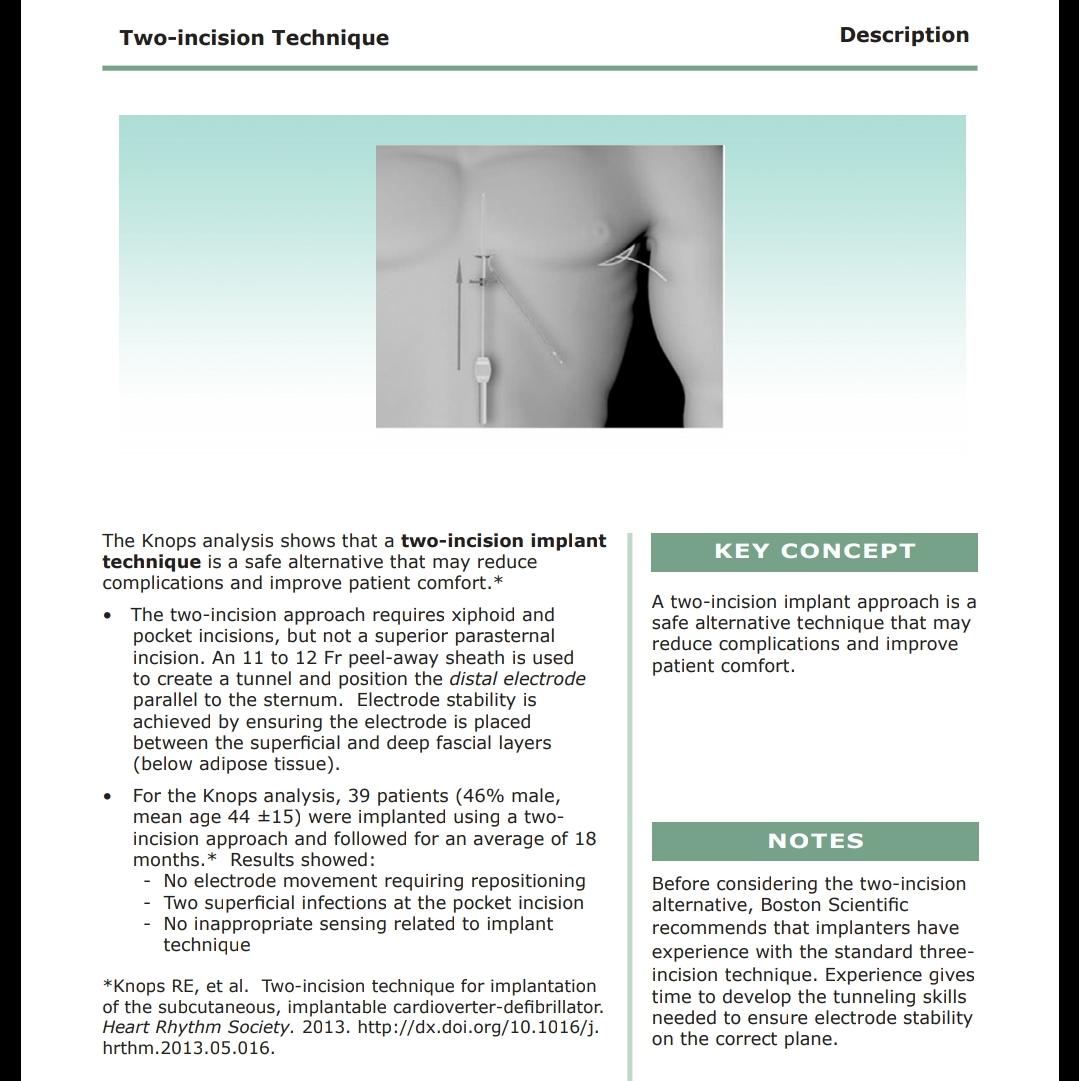 CVT Mohd Farid: Implant Management Of Subcutaneous ICD Boston Emblem SICD