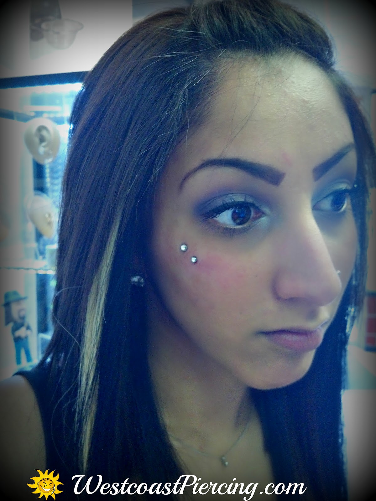 Surface Bar Piercing Removal at Faith Fussell blog