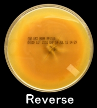 Fun With Microbiology (What's Buggin' You?): Trichophyton tonsurans