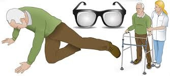 Nursing cares in the elderly patients.: GERIATRIC SYNDROME FALL