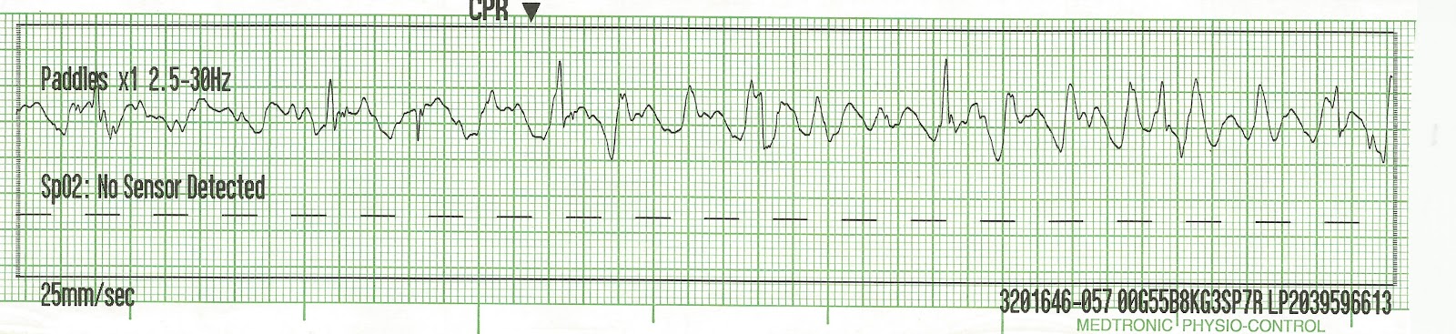 Float Nurse: Code Blue: Respiratory arrest
