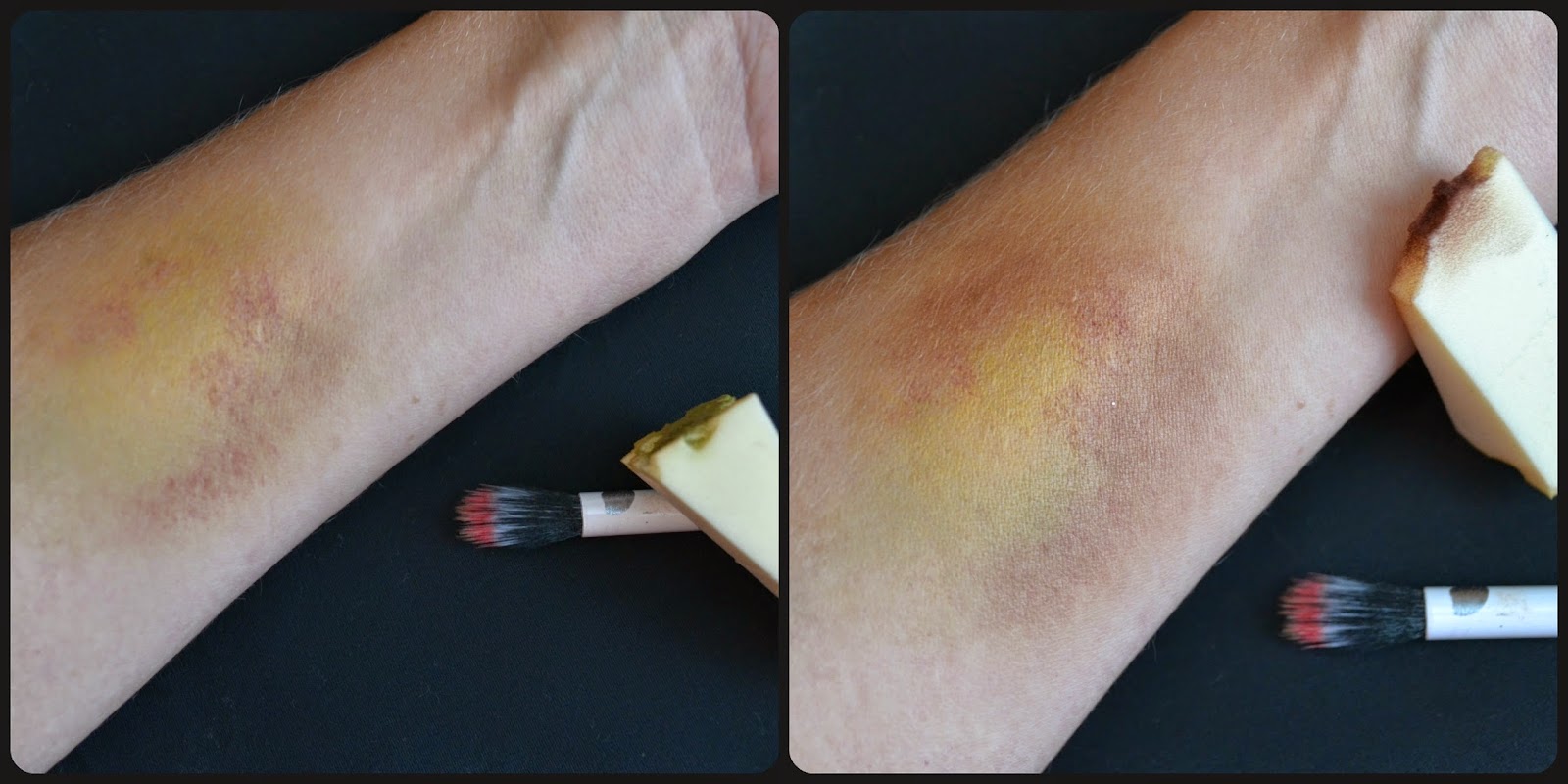 How to create a bruise...