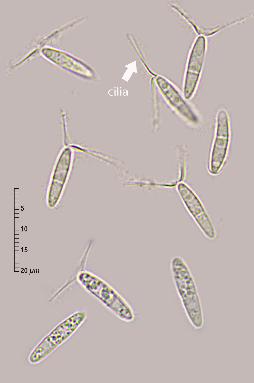Microthyrium ilicinum De Not. • CEMAS • Orden Microthyriales