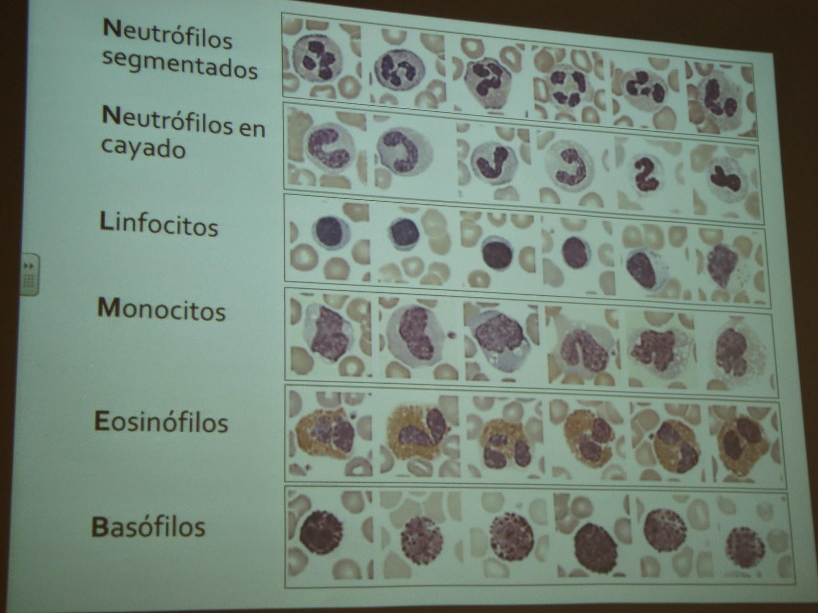 CUADERNO DE PRÁCTICAS HEMATOLOGÍA: Práctica: Fórmula Leucocitaria.