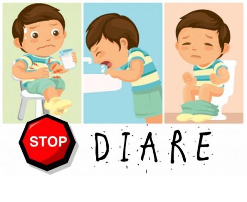 Laporan pendahuluan DIARE