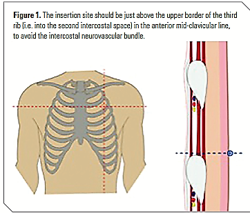 EMS SOLUTIONS INTERNATIONAL by @DrRamonReyesMD marca registrada ...