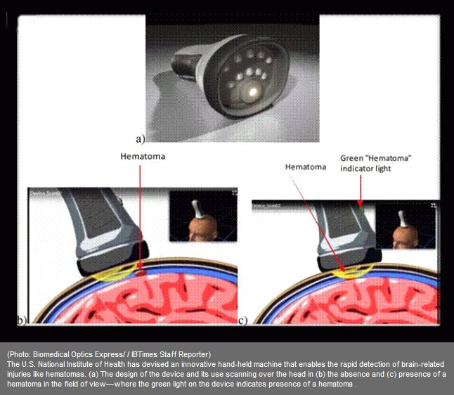 Suburban spaceman: Scientists Develop Hand-Held Brain Injury Detector