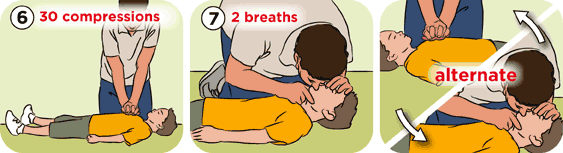 PBSM UiTM Dungun: Pertolongan Cemas - CPR