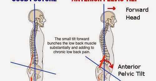 Total Athletic Therapy: Hamstrings: Tight vs. Taut