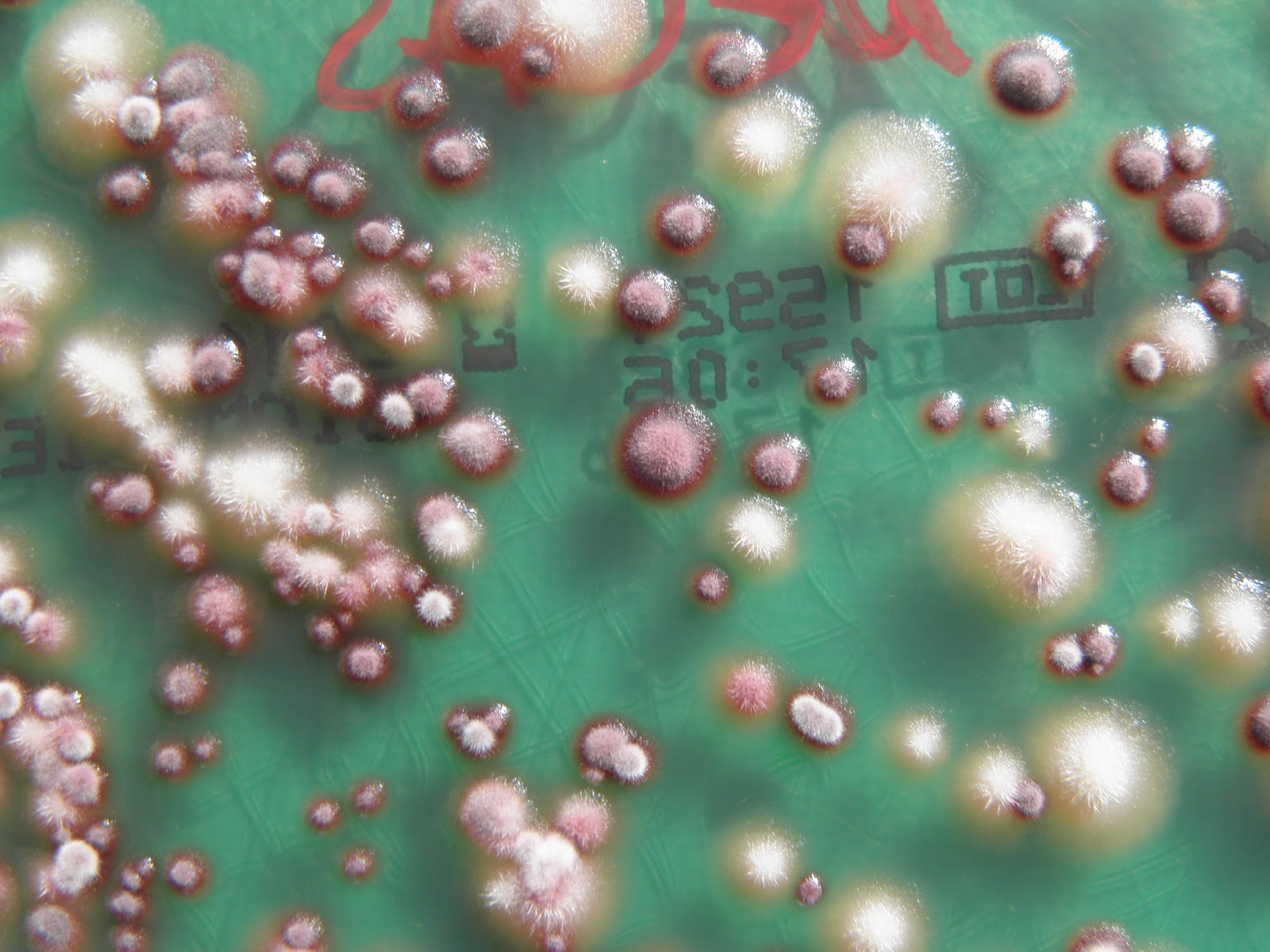 ATLAS MICOLOGIA: TRICHOPHYTON VIOLACEUM