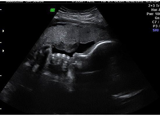 The Whaleys: 31 Week Ultrasound