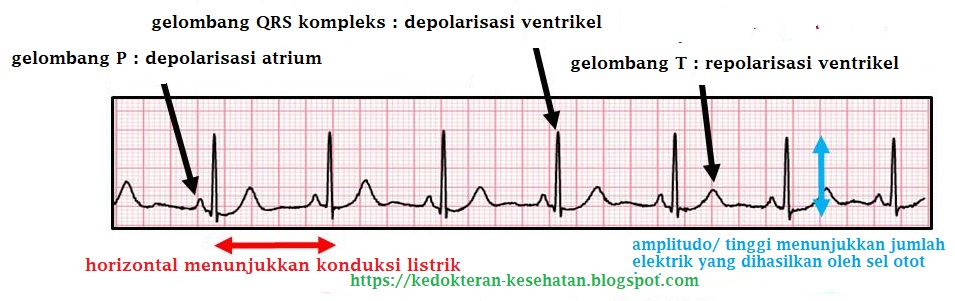 Bagaimana Gambaran EKG Yang Normal Itu? - KLIK INSTAL