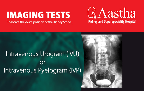 Kidney Stone Diagnosis ~ Aastha Kidney Hospital Ludhiana