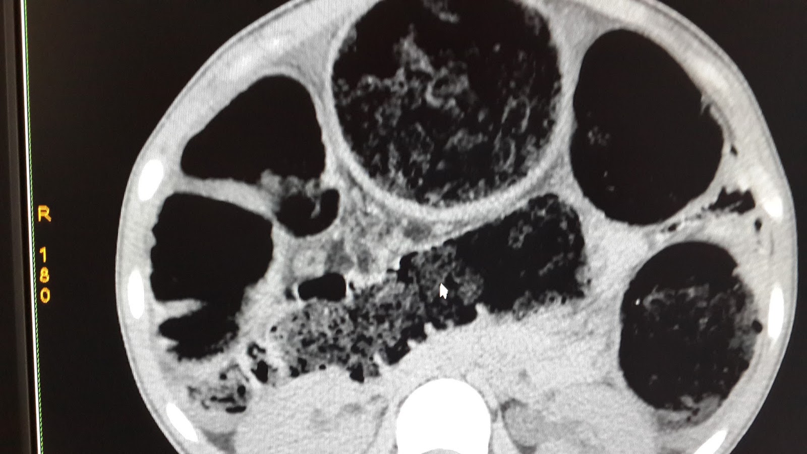 EL RINCÓN DE LA MEDICINA INTERNA. juanpedromacaluso@yahoo.com.ar ...