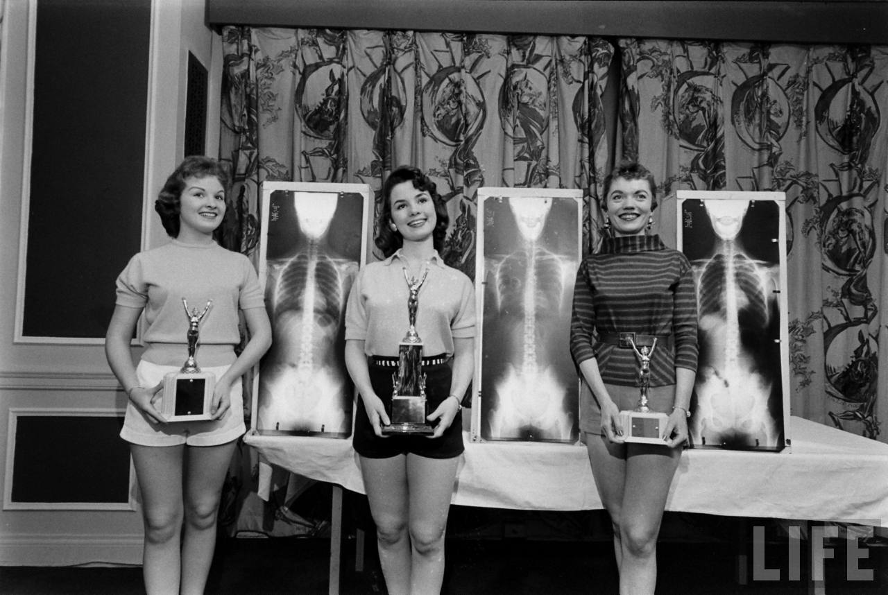 Miss Correct Posture: Pictures From a Chiropractor's Beauty Contest ...