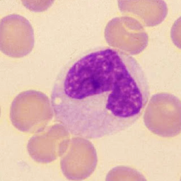 Blog del Laboratorio clinico : Monocitos