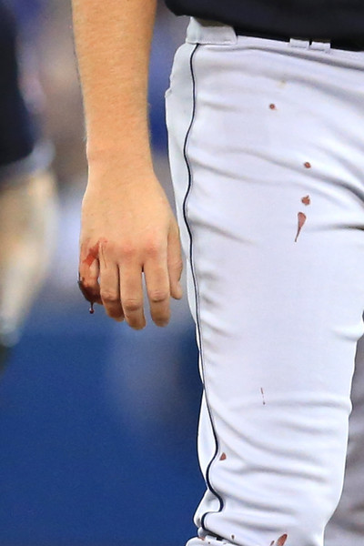 Bleeding Yankee Blue: FROM A BLOODY WIN TO THE JAYS STILL BREATHING!