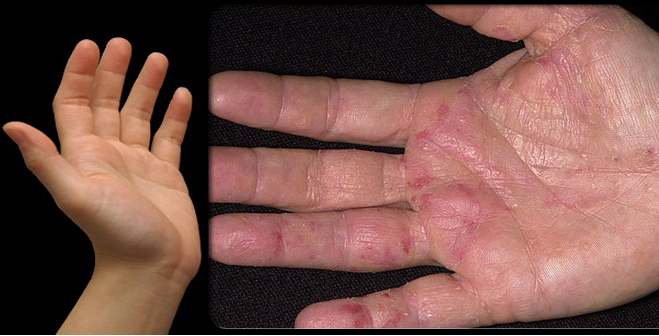 Cancer Symptoms First Appear On Your Hands – Don’t Ignore Them