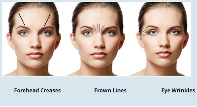 Sleep Lines Prevent Sleep Lines and Forehead Wrinkles Cure