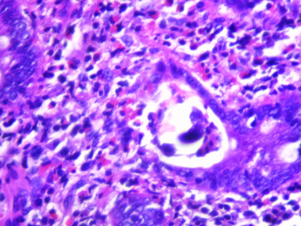 GASTROINTESTINAL AND LIVER HISTOLOGY PATHOLOGY ATLAS: DUODENUM ...