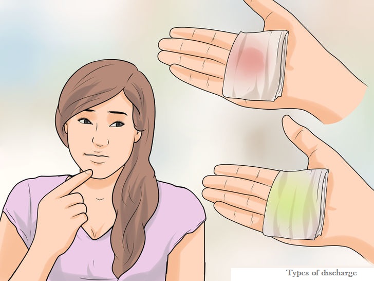 Types of discharge: What is the normal and abnormal? | MY MENSTRUATION