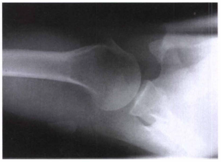 INFEROSUPERIOR AXIAL PROJECTION: SHOULDER (NON TRAUMA) - RadTechOnDuty