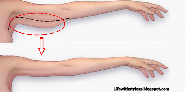 30 Minutes Exercises to Lose Arm Fat in 1 Week at Home (No Equipment ...