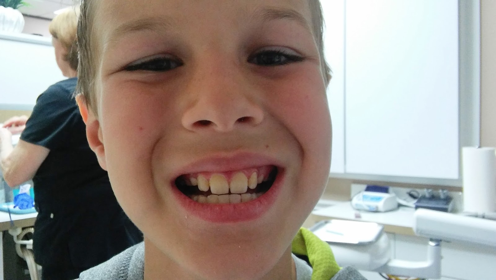 Live Laugh Lopez: Matt's Chipped Tooth