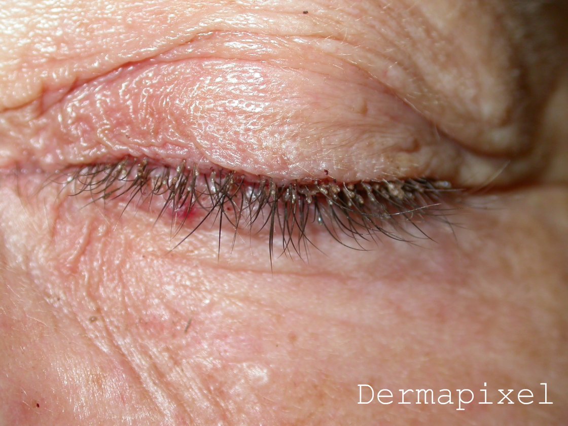 Dermapixel: octubre 2012