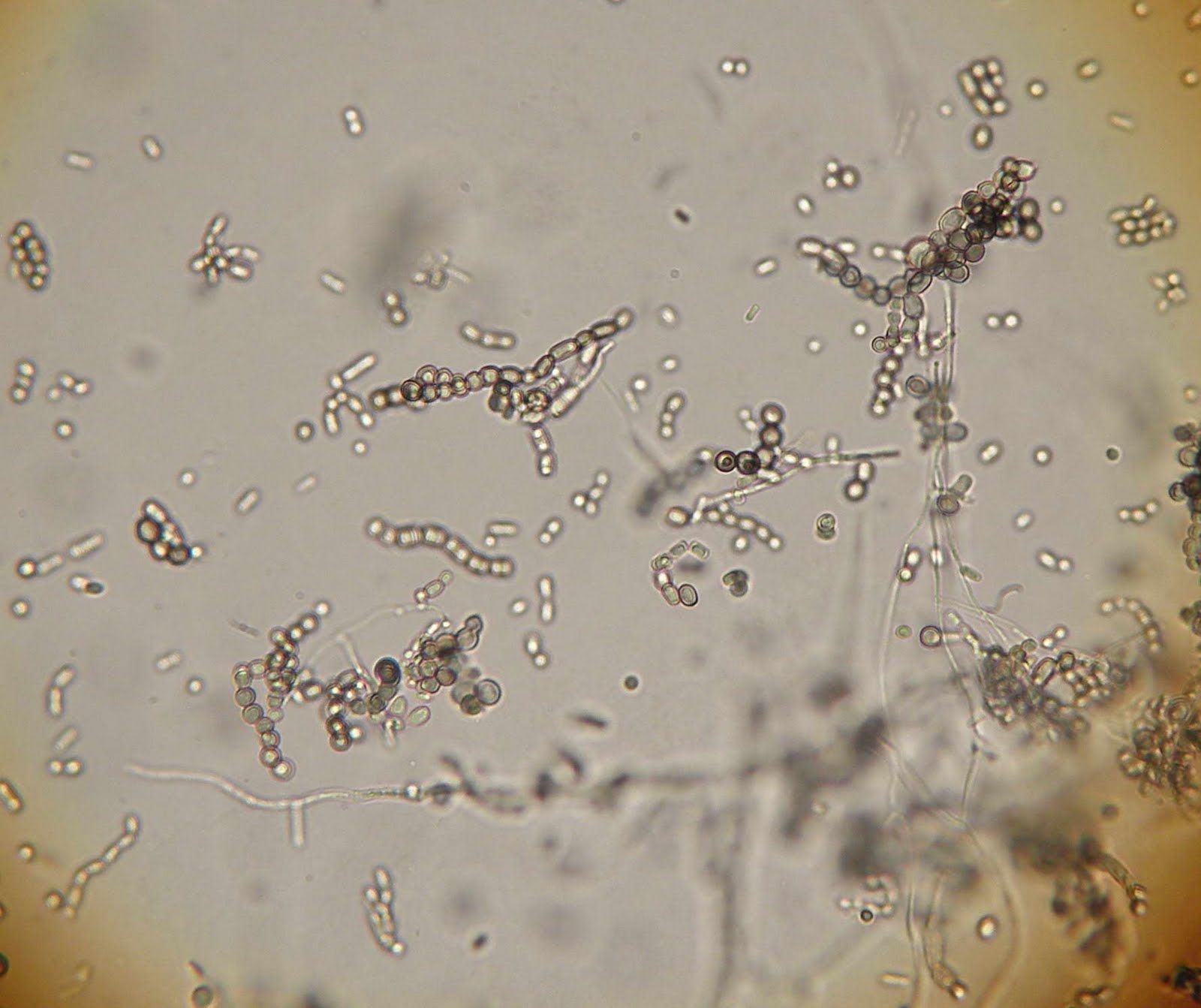 ATLAS MICOLOGIA: SCYTALIDIUM DIMIDIATUM (Neoscytalidium dimidiatum)
