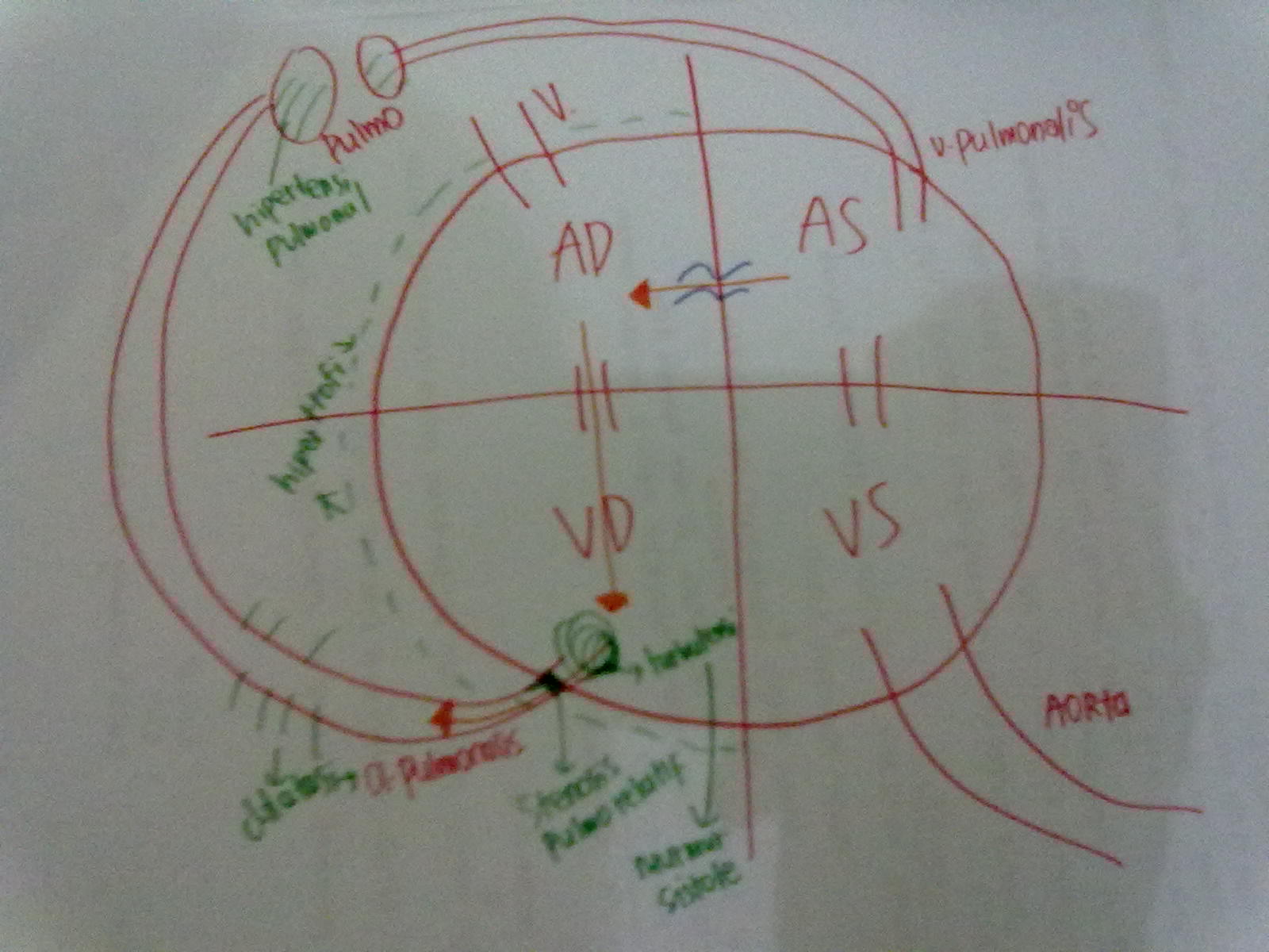 ASD (Atrial Septa Defect) ~ TheBloLabo.