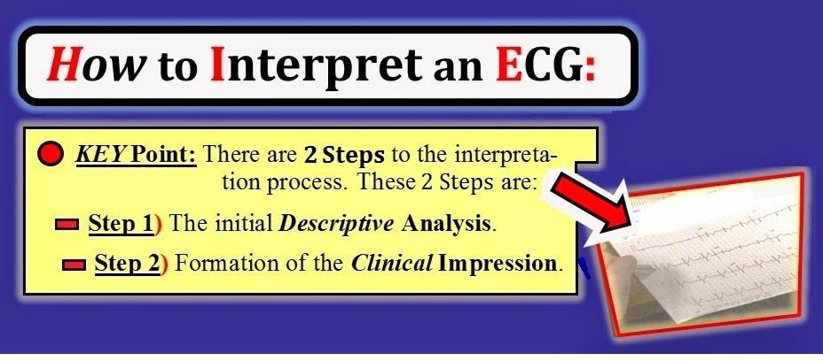 ECG systemic approach : 네이버 블로그