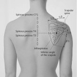 Acupuncture: SI - 11 (SMALL INTESTINE - 11)