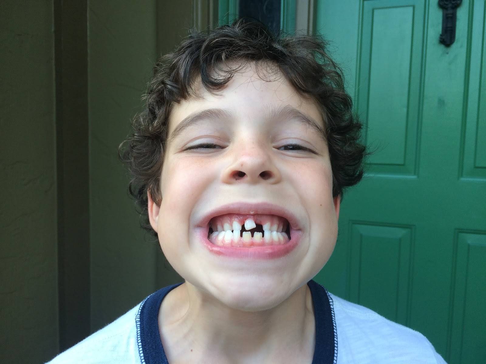 The Connelly Chronicles: THREE Front Teeth