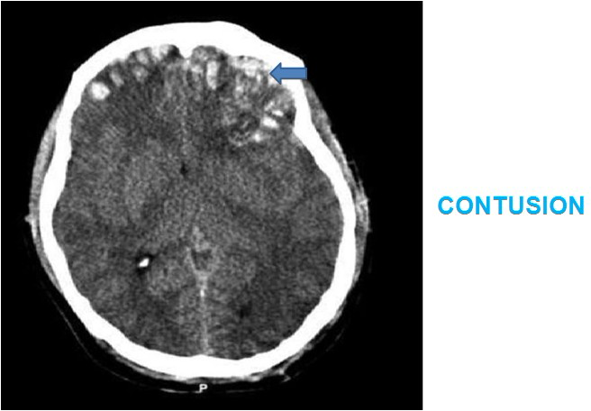 Doctors Network: CT SCAN OF HEAD