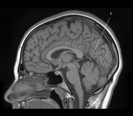 Ultimate Radiology : FRCR 1 ANATOMY QUESTION : 6