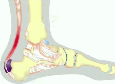 En ny begynnelse: Skader