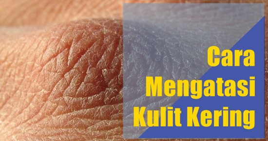 25 Cara Alami Mengatasi Kulit Kering