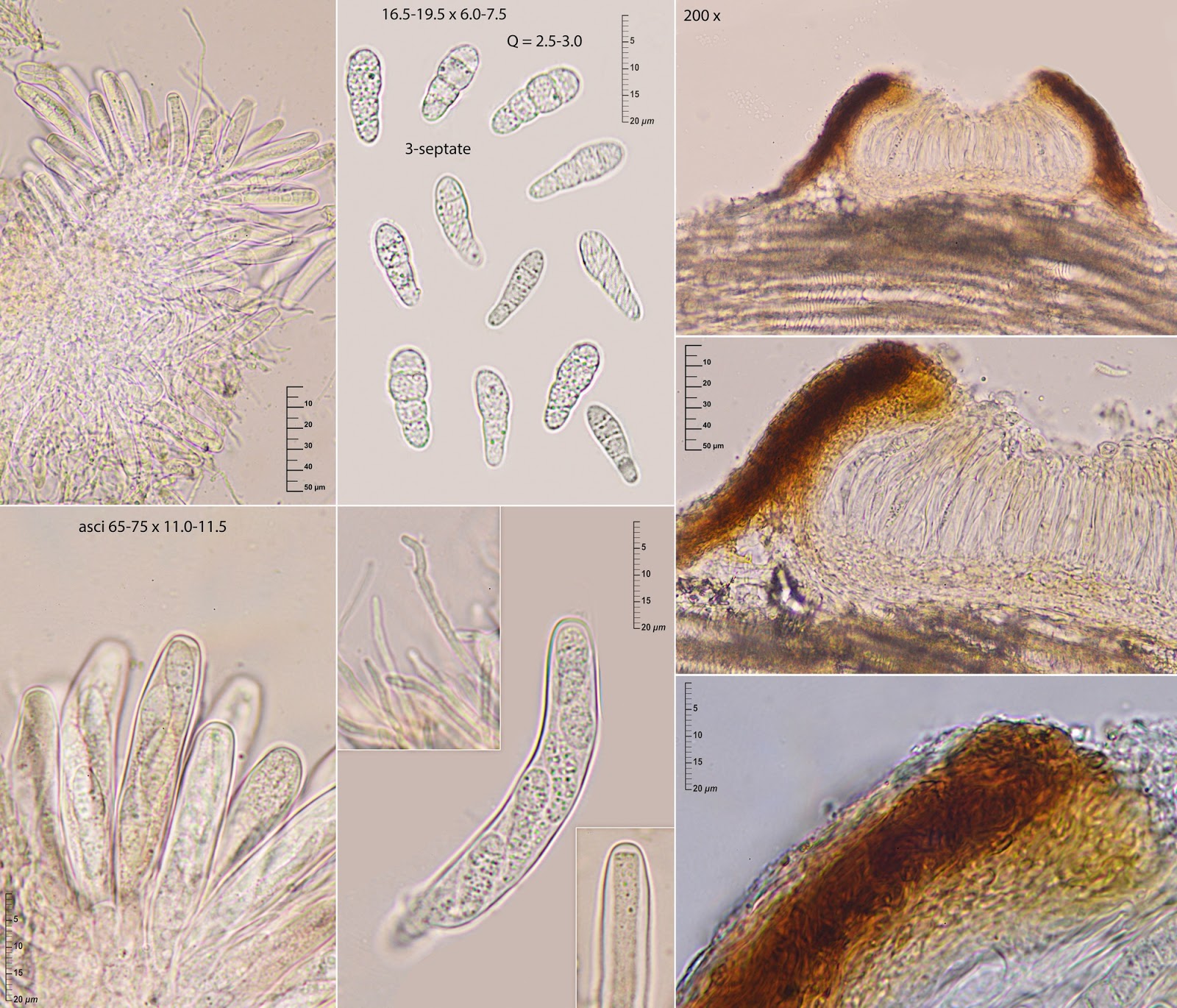 Exarmidium inclusum (Pers.) Aptroot • CEMAS