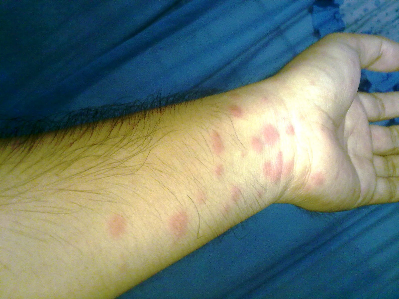 The JAKE POSITIVE BLOG: 2ND WEEK AND 3RD WEEK OF ARV TRIAL