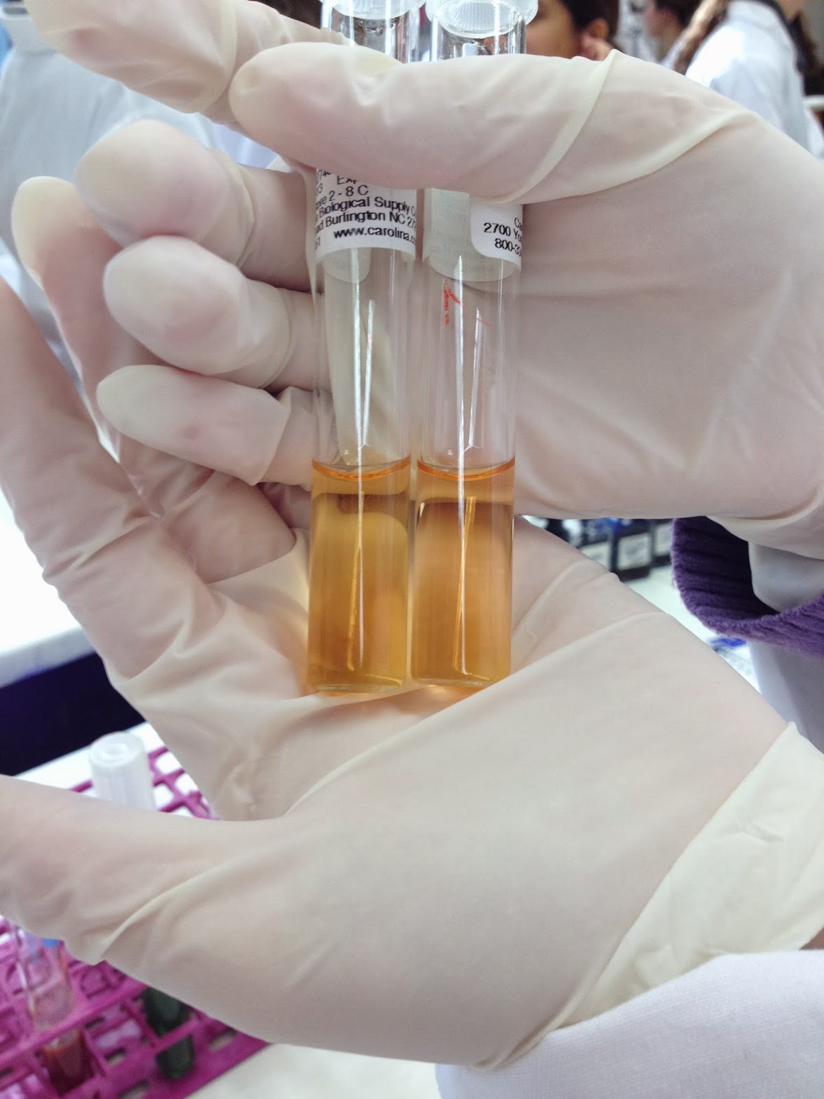 Ari and Johanna's Medical Microbiology Lab Report : Indole, Urea ...