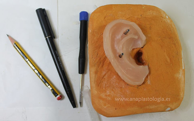 Anaplastologia: Prótesis auricular