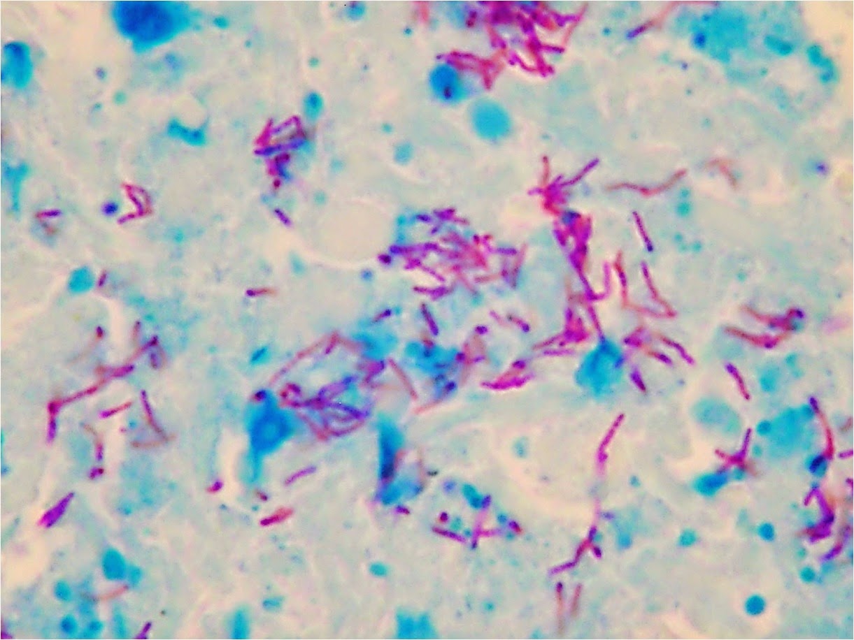 Primeros Años de Medicina: Las bacterias resistentes (BAAR)