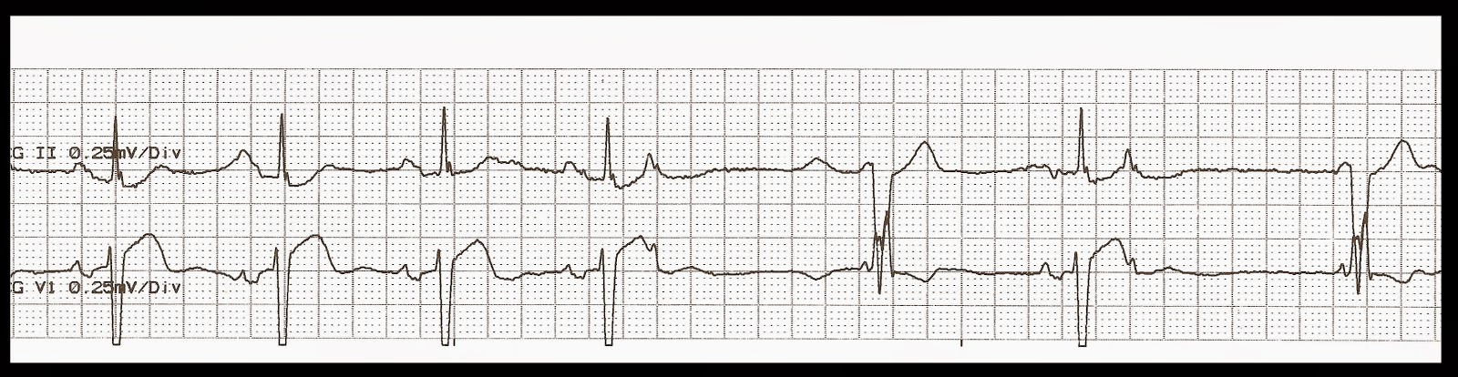 Practice EKG Strips 344